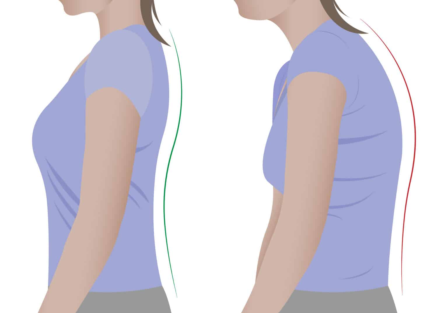 Fisioterapia: Avaliação Motora E Alterações Posturais Comuns - Blog Da ...