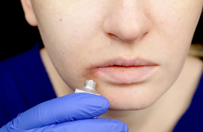 Aciclovir é Antibiótico ? - Blog Da Saúde