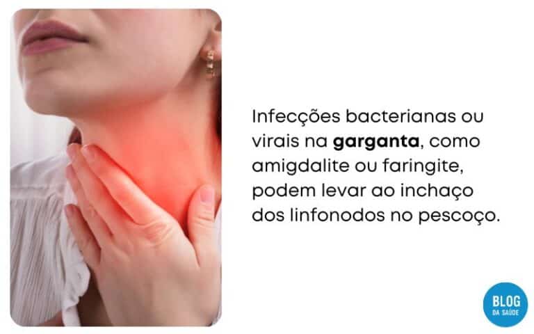 Caroço Dolorido No Pescoço - O Que Pode Ser? - Blog Da Saúde