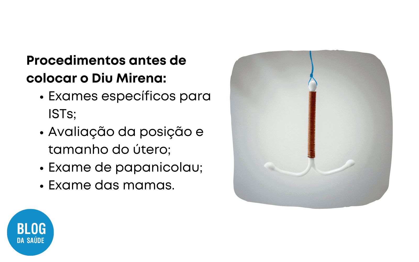 DIU Mirena Engorda? Tire As Principais Dúvidas Sobre O Assunto - Blog ...