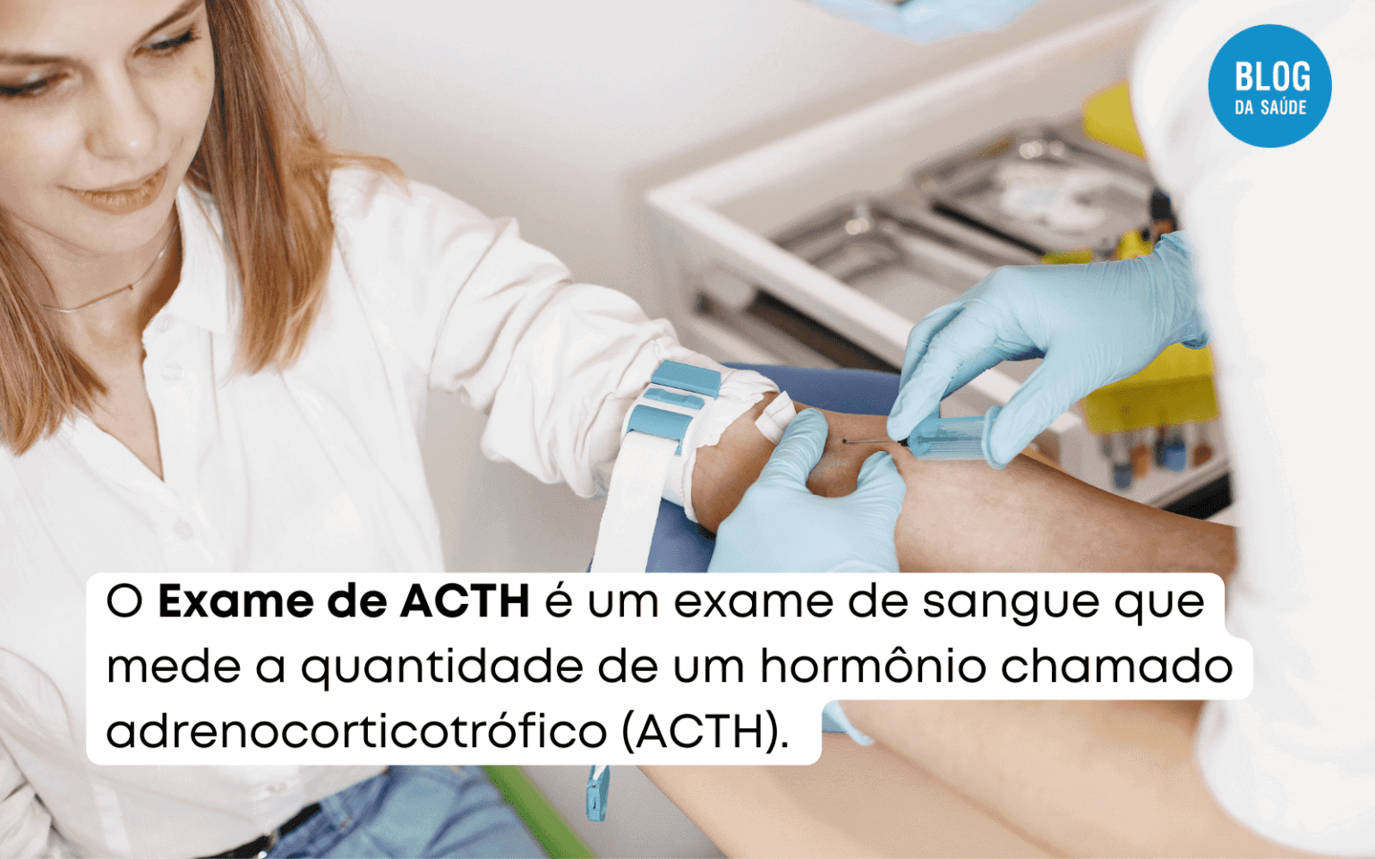 Exame De ACTH: Para Que Serve? - Blog Da Saúde