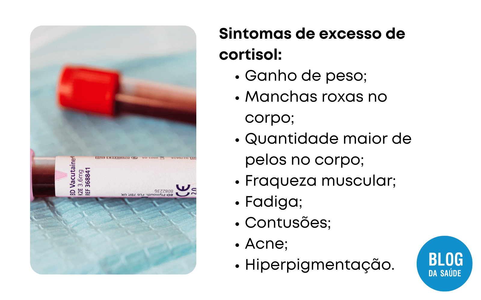 Exame De ACTH: Para Que Serve? - Blog Da Saúde