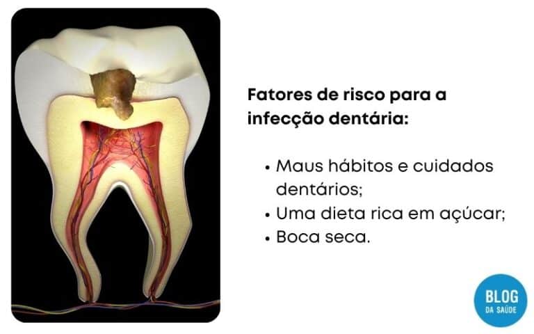 Infecção No Dente - Sintomas, Fatores De Risco E Como Prevenir! - Blog ...