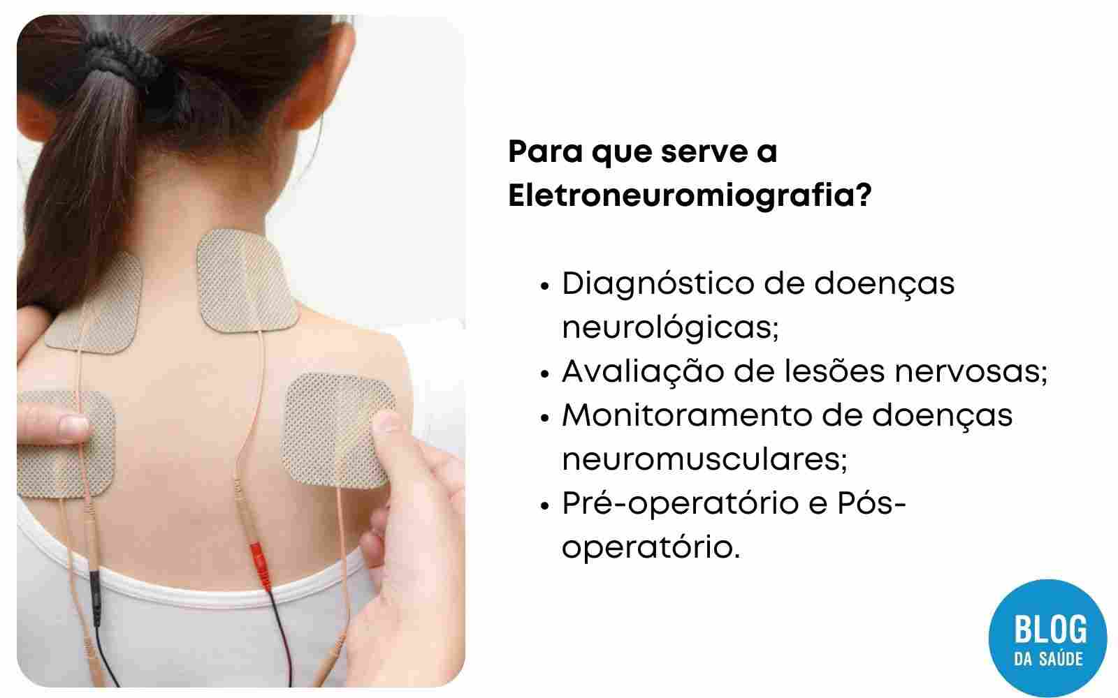 What is Electromyography (ENMG)? What is it for?