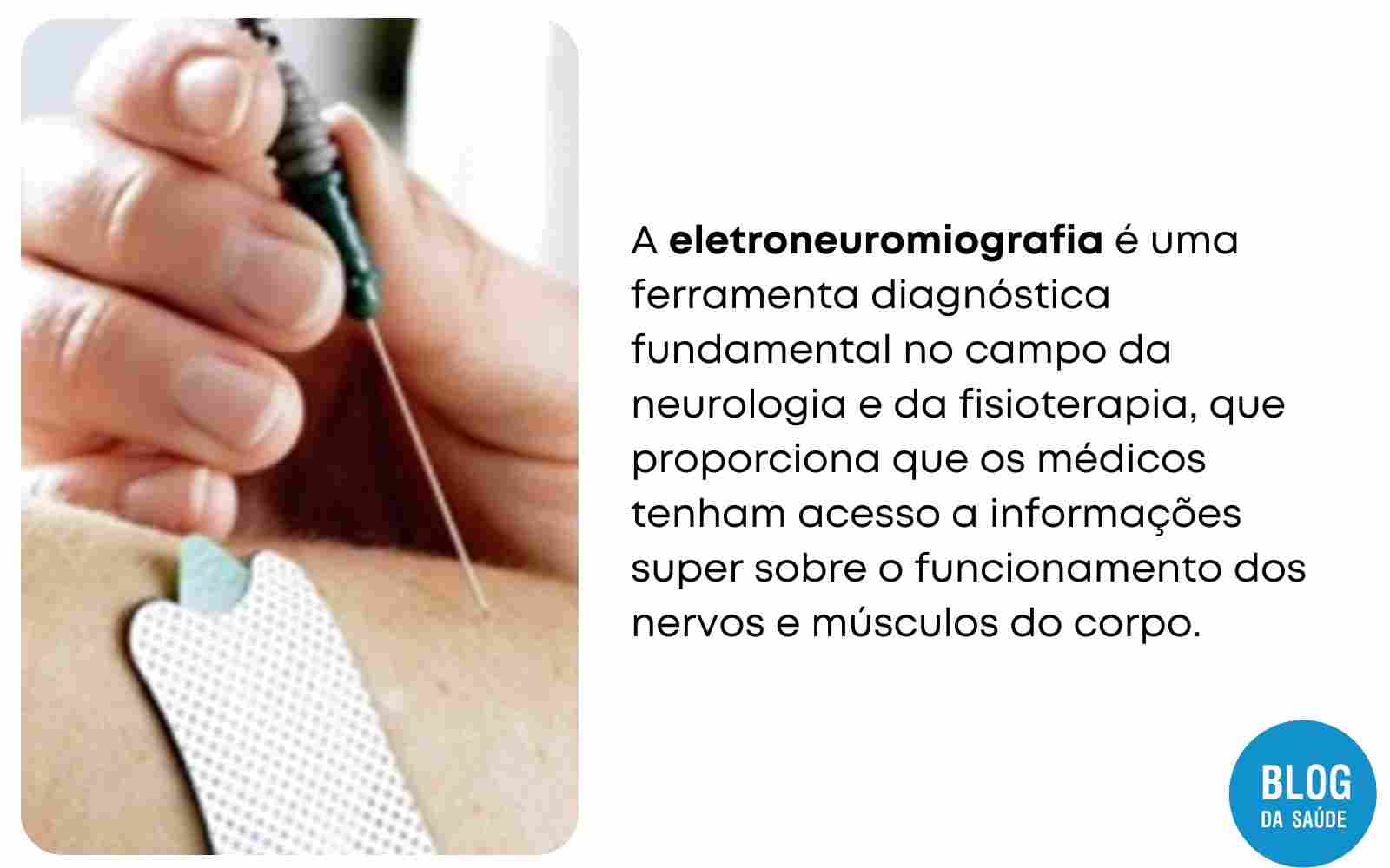 What is Electromyography (ENMG)? What is it for?