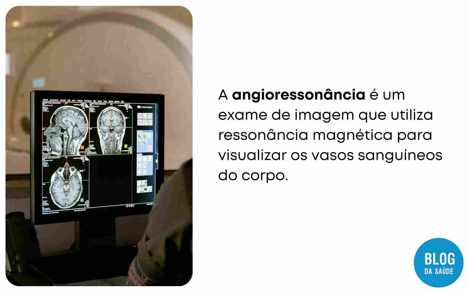 What is MRI angiography for? Find out in this article!
