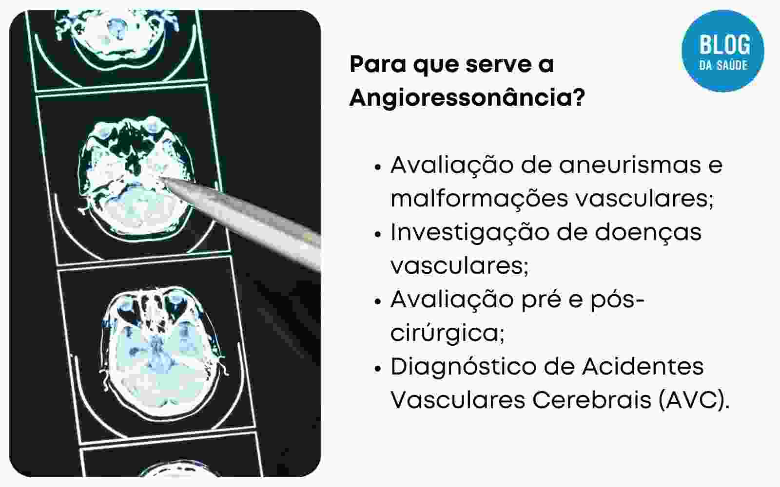 What is MRI angiography for? Find out in this article!