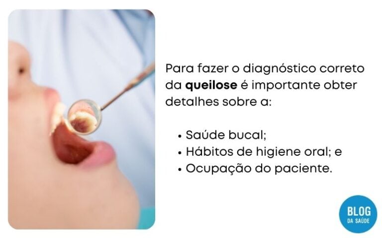 Queilose (Queilite Angular) - O Que é, Quais São Os Sintomas E Como ...