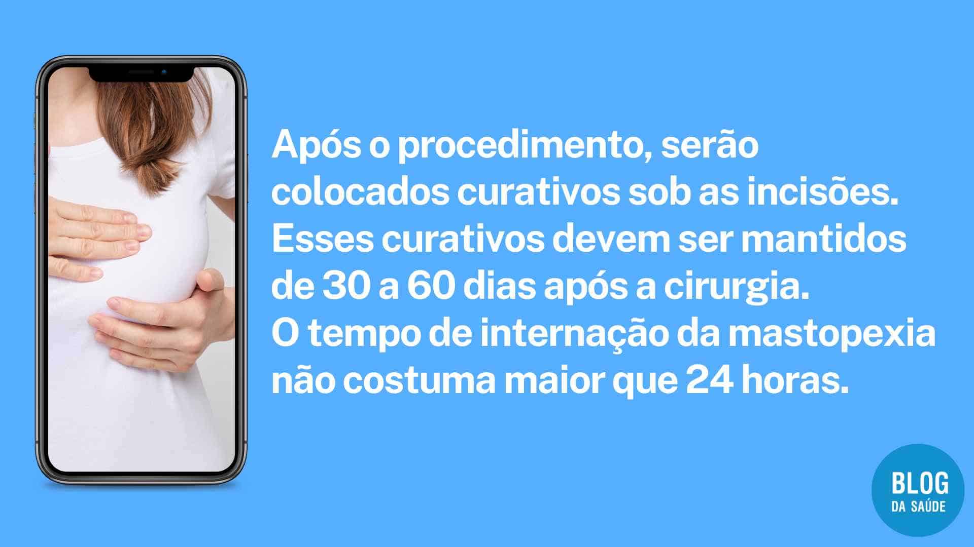 Mastopexia: Correção De Flacidez Da Mama - Blog Da Saúde