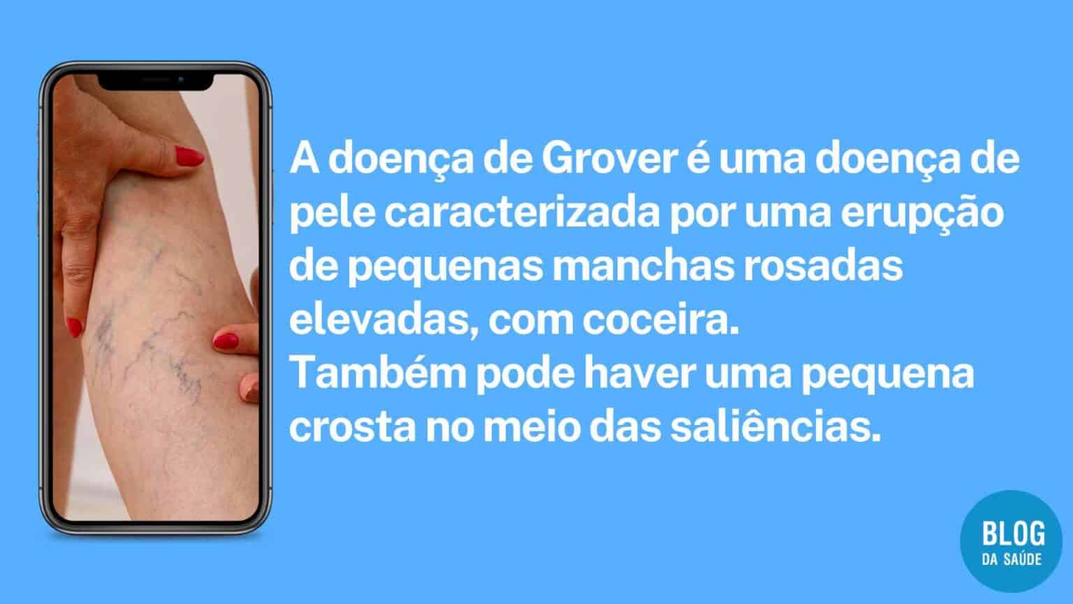 Doença De Grover - Dermatose Acantolítica Transitória - Blog Da Saúde