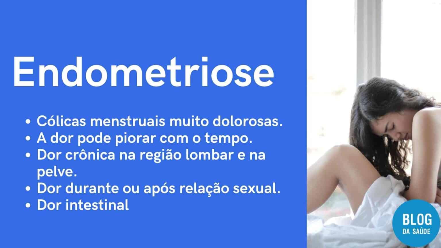 Endometriose - O Que é? Causas, Sintomas E Tratamentos - Blog Da Saúde