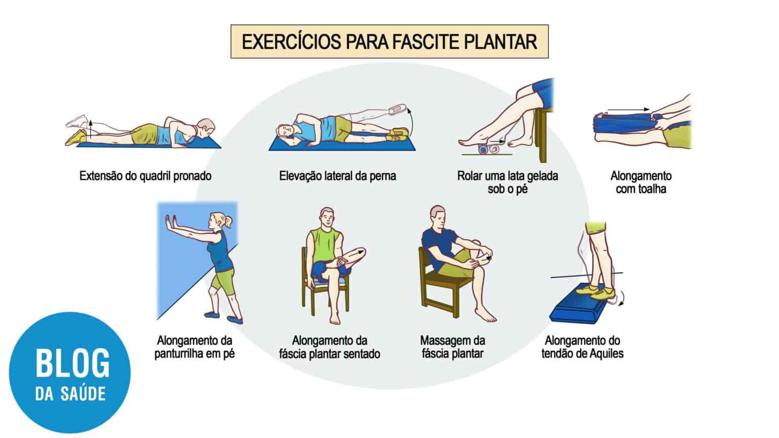 Fascite Plantar - O Que é? Causas, Sintomas E Tratamentos - Blog Da Saúde