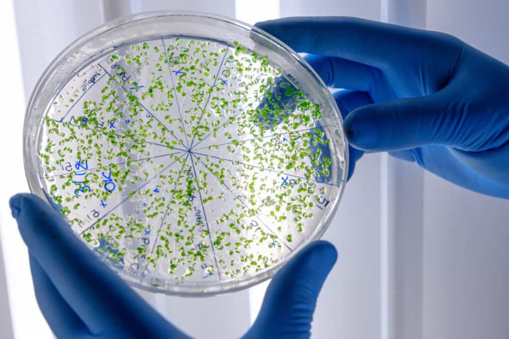 O Antibiograma Ou Teste De Sensibilidade Antimicrobiano - Blog Da Saúde