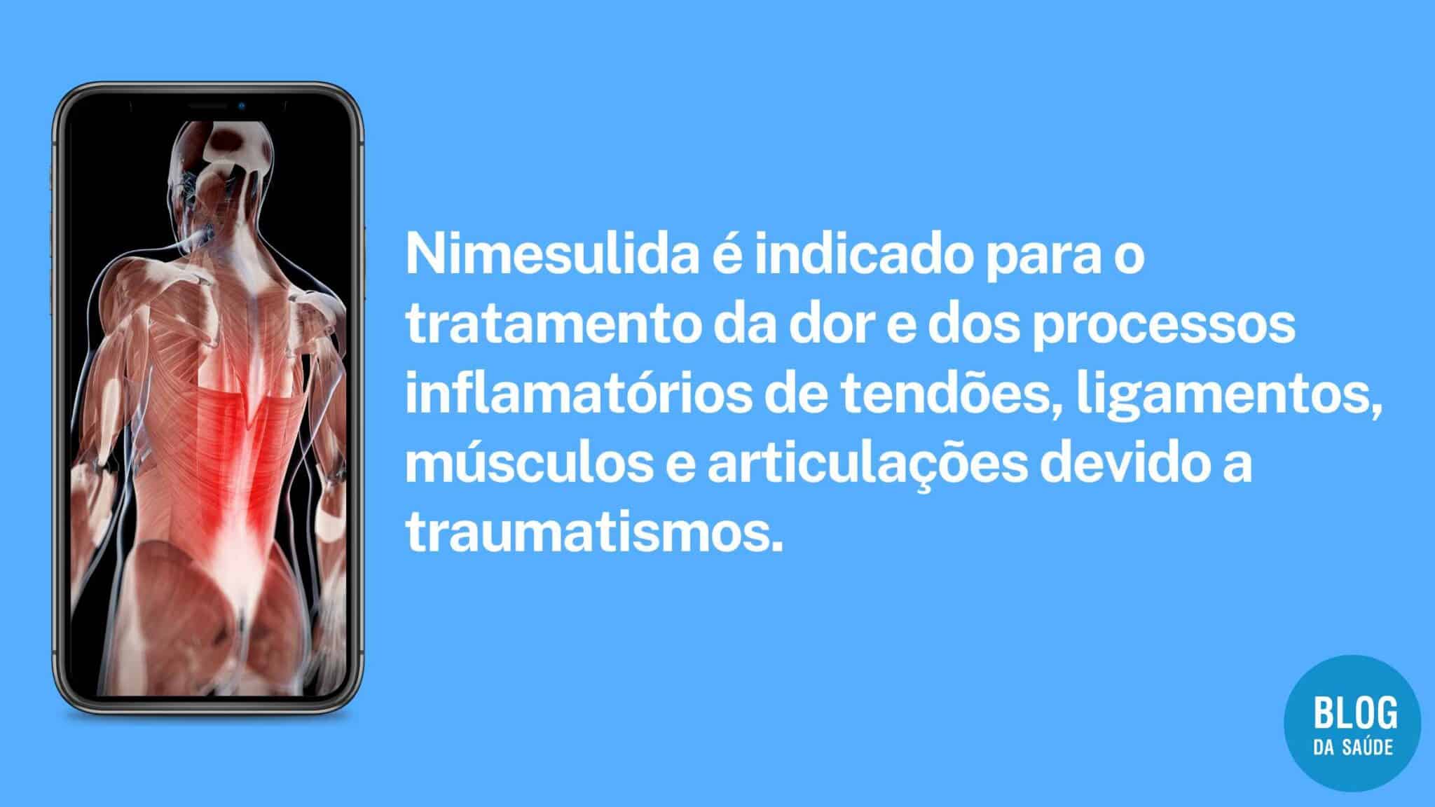 Nimesulida Serve Para Dores De Cabeça? Saiba Mais Sobre O Medicamento ...