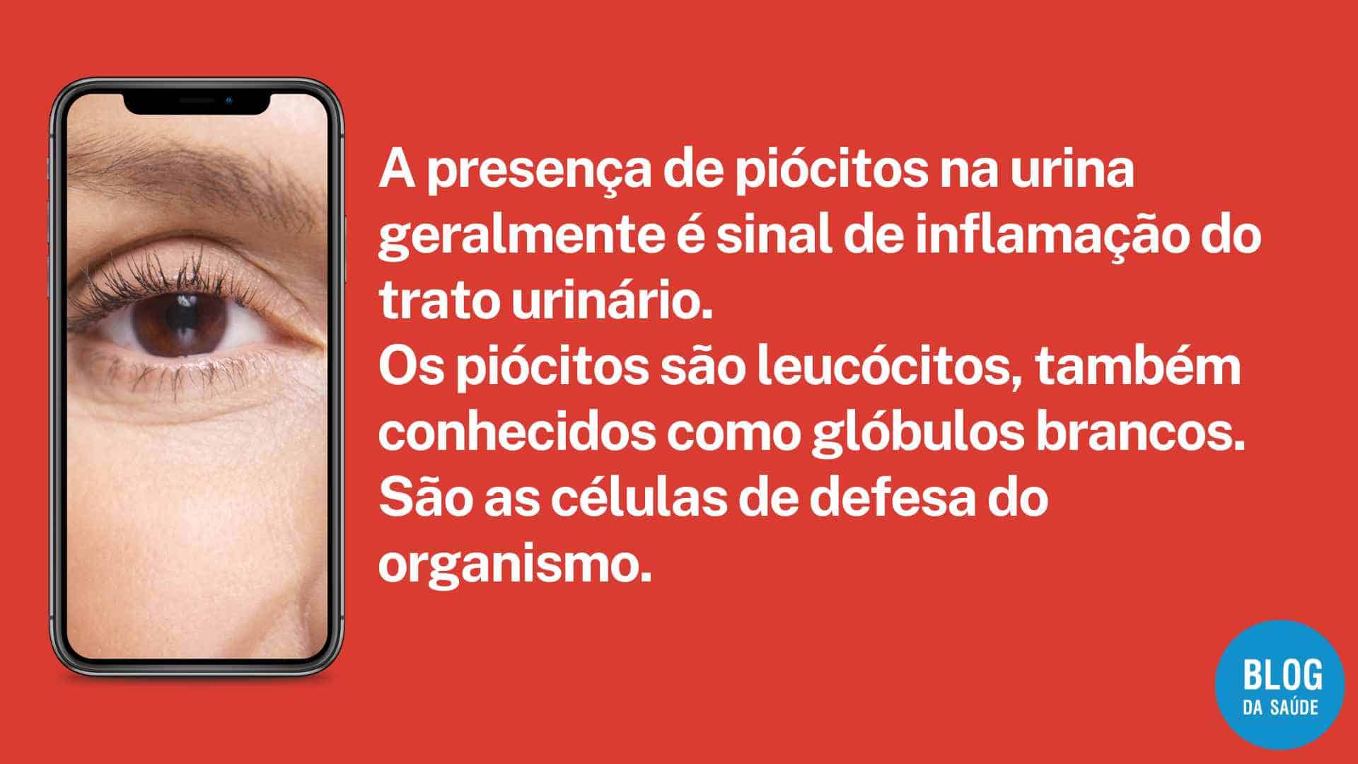 Piócitos Na Urina - Blog Da Saúde