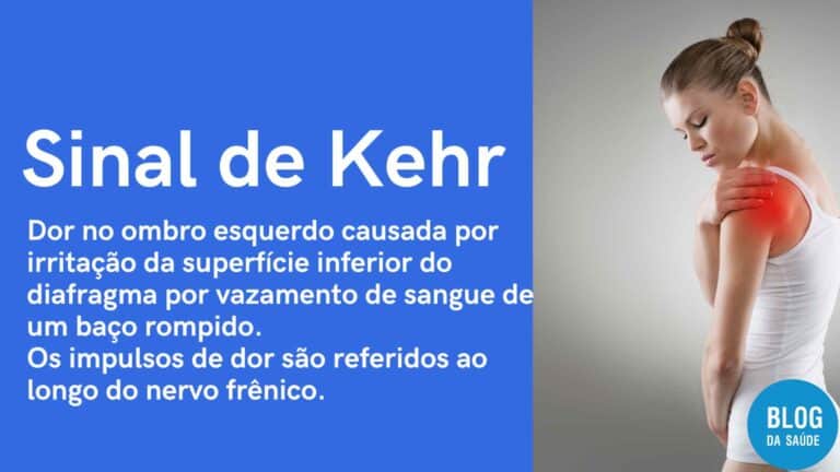 Sinal De Kehr - Dor No Ombro Por Lesão Esplênica - Blog Da Saúde