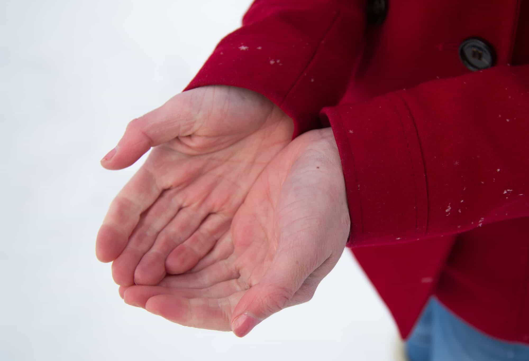 Síndrome De Raynaud (Fenômeno De Raynaud) - O Que É? Sintomas E ...
